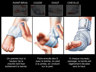 Encyclopédie Larousse en ligne - bandage