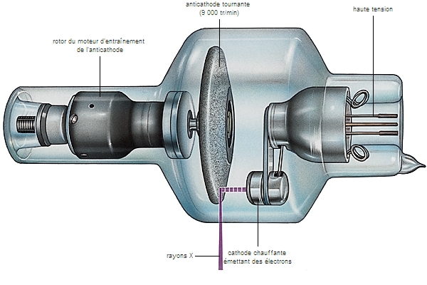 Encyclopédie Larousse en ligne - rayons rayonnement X