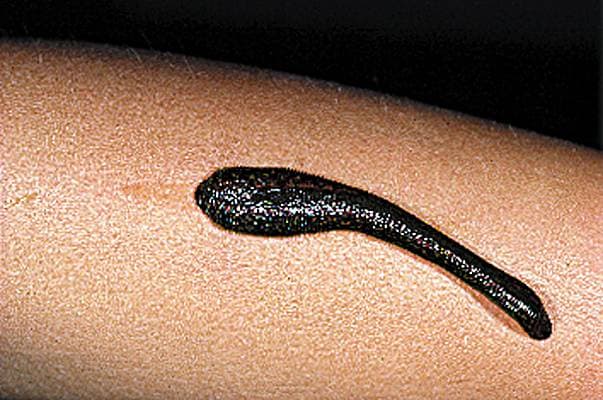 sangsue latin sanguisuga de sanguis sang et sugere sucer - LAROUSSE