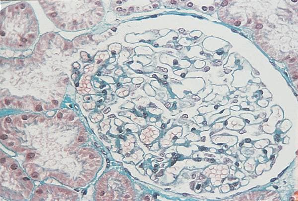 glomérule - LAROUSSE