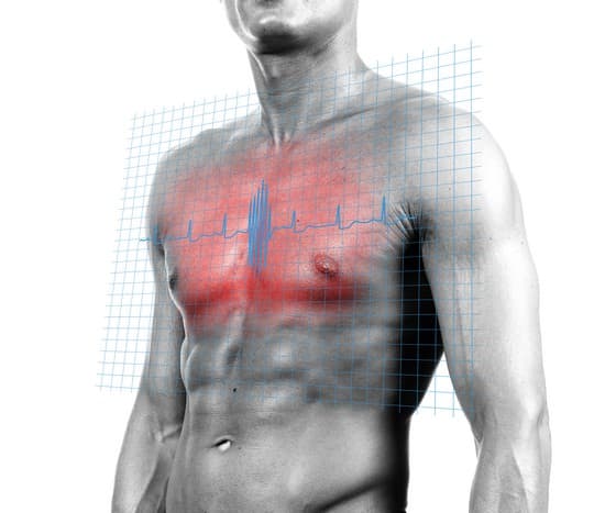 Représentation graphique d'une attaque cardiaque – Média LAROUSSE